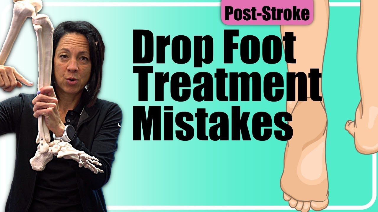 Foot Drop Versus Spasticity Post Stroke - YouTube