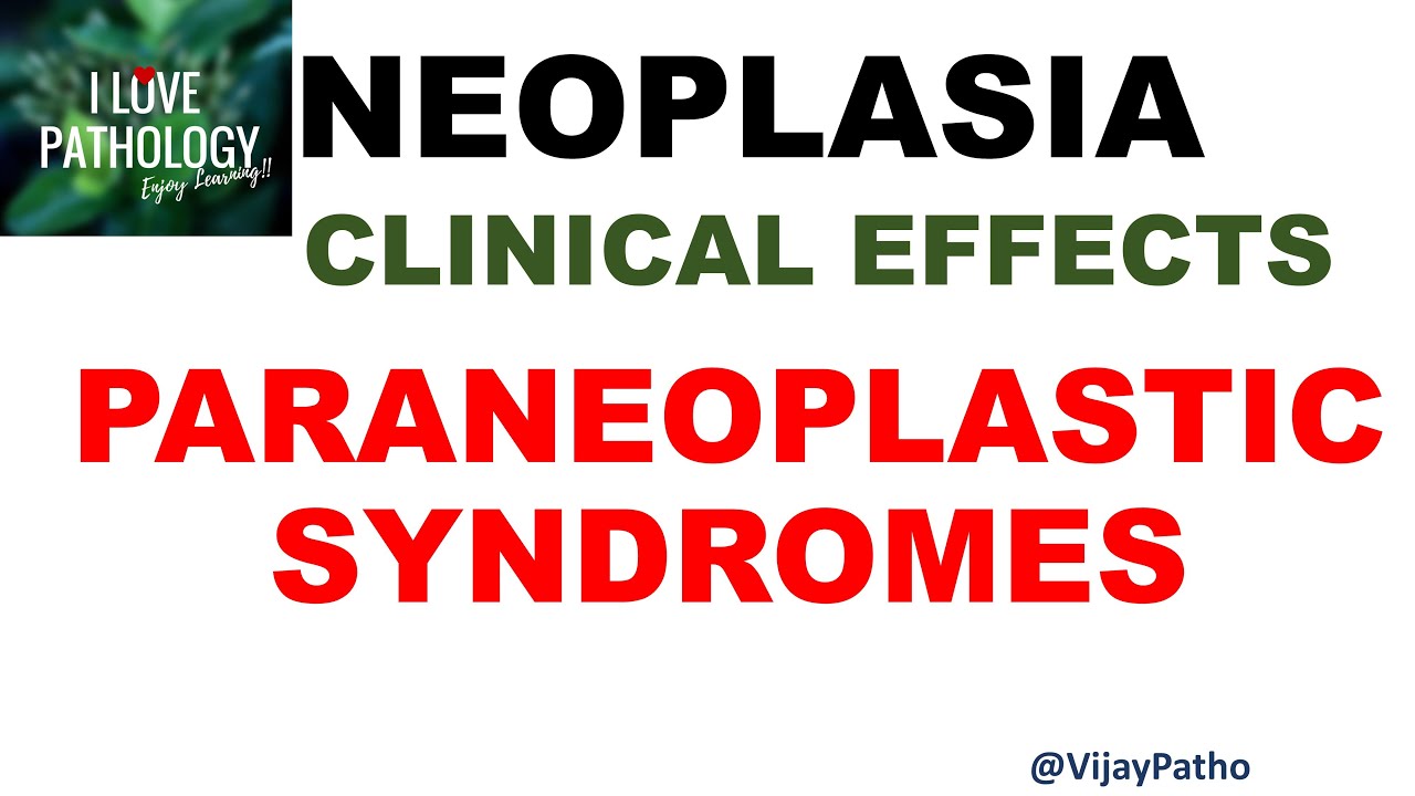 NEOPLASIA Part 10: CLINIAL EFFECTS OF CANCER: Cancer Cachexia ...