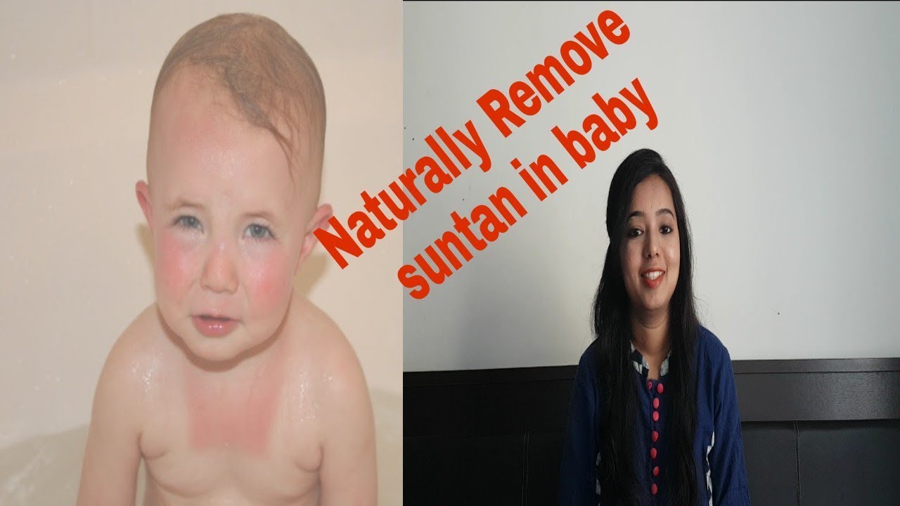 How to Remove Sun Tan Naturally in Baby || कैसे हटाये sun tan नैचुरली ...