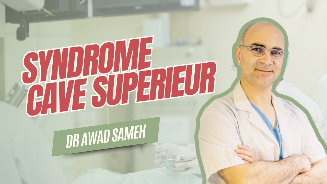SYNDROME CAVE SUPÉRIEUR - YouTube