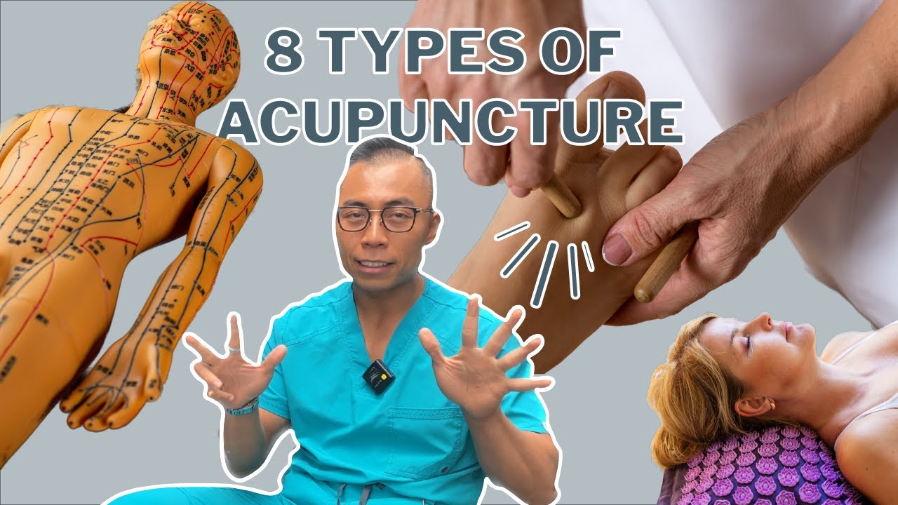 Did you know there's 8 Types of Acupuncture? Cody Explains all | Body ...