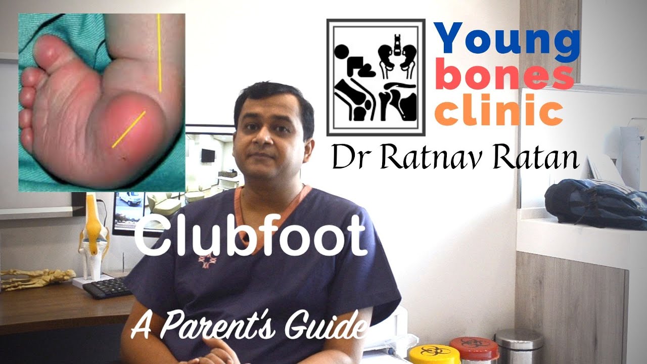 Club foot| Parent's guide-Dr Ratnav Ratan|क्लब्फूट का इलाज समझें Birth ...