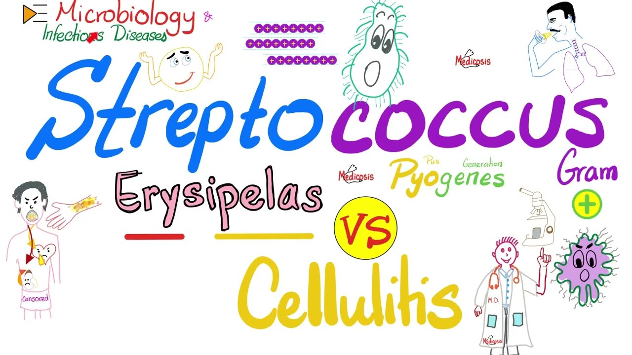 Erysipelas vs Cellulitis | Group A ß-hemolytic Streptococcus ...