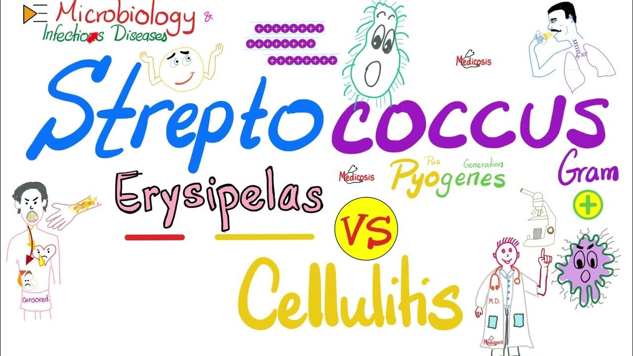 Erysipelas vs Cellulitis | Group A ß-hemolytic Streptococcus ...