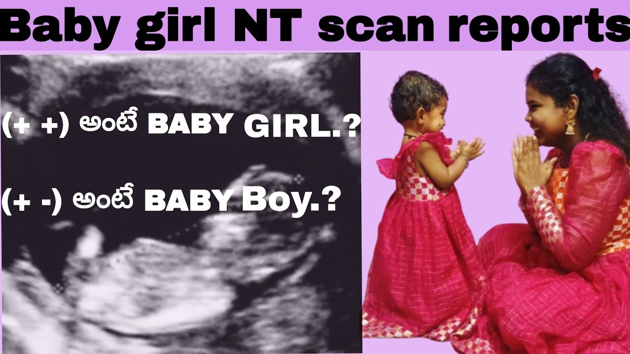 My baby girl NT scan reports || (+ - )simbols నీ బట్టి Gender ...