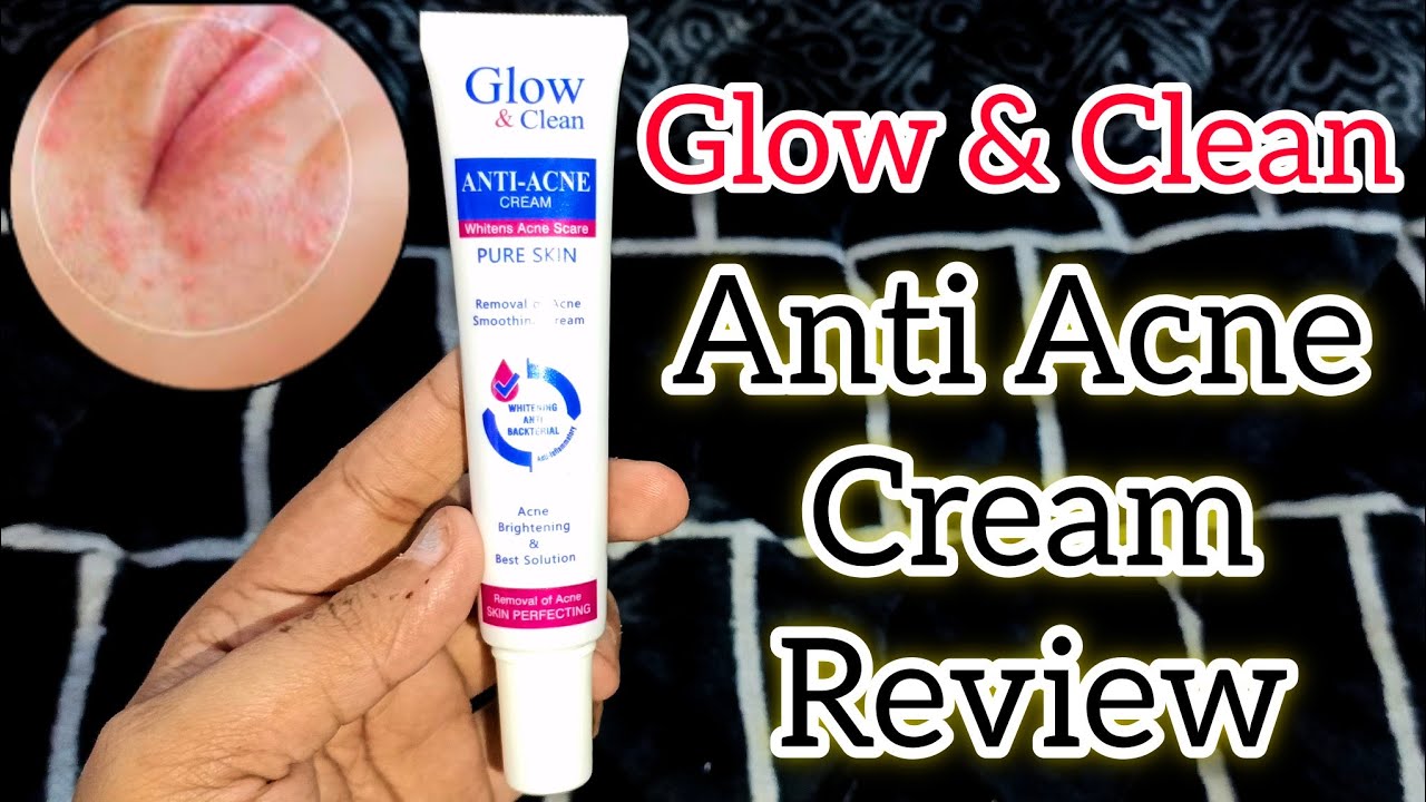 Glow and Clean Anti Acne Cream Review | acne cream review | glow and ...