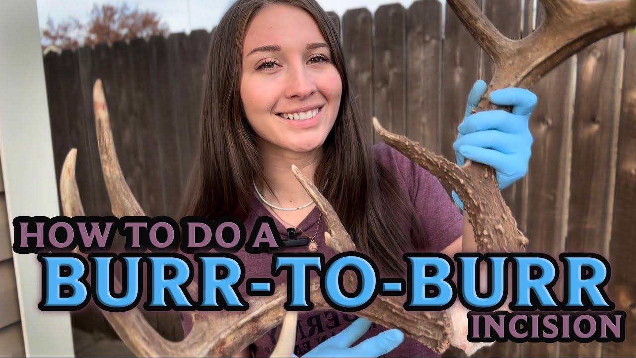 How to do a Burr to Burr Incision - YouTube