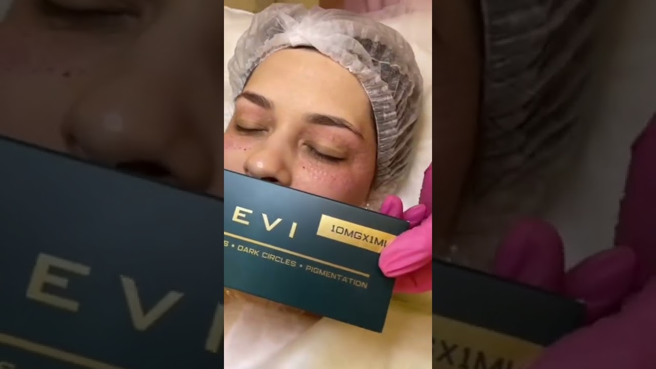 Revi eye correction биоревитализация #москва #салонкрасотымосква # ...