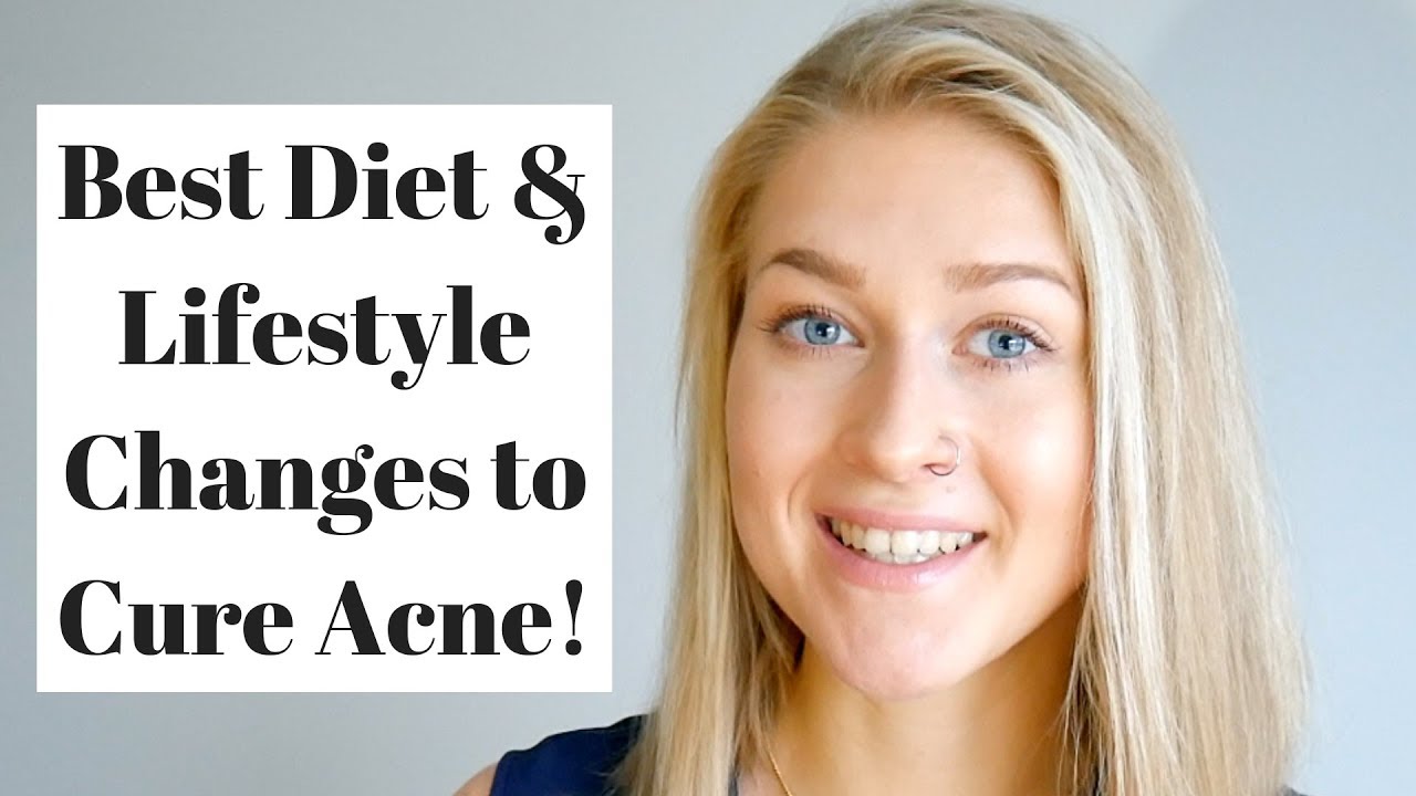 ACNE-FREE Skin. Food to Eat. Best Lifestyle Changes. - YouTube
