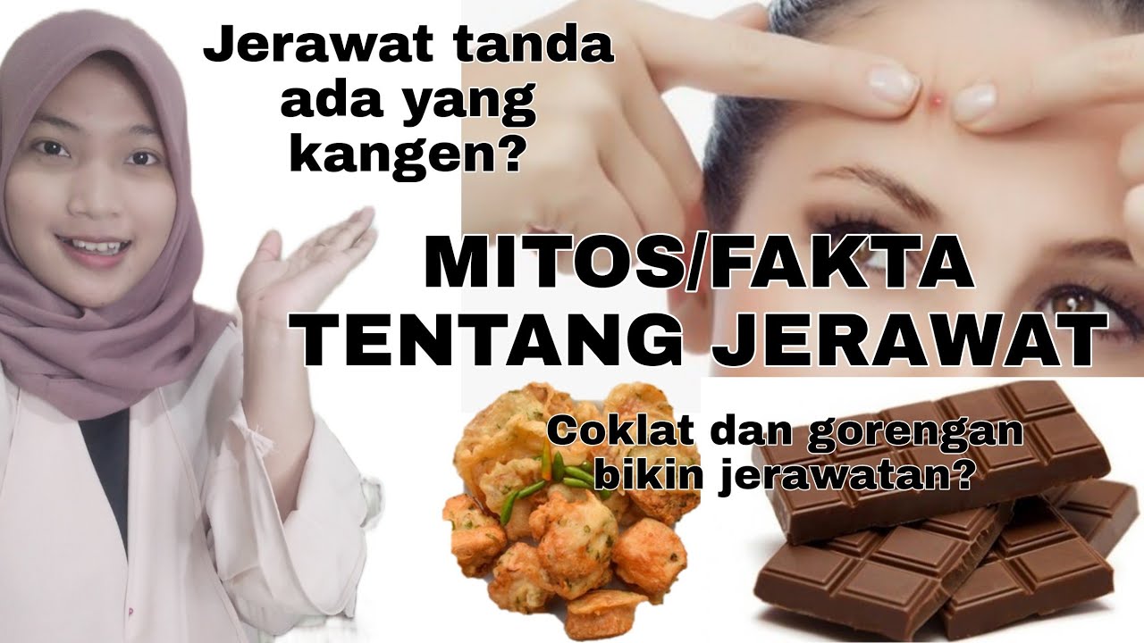 MITOS TENTANG JERAWAT Yang Tidak perlu dipercaya!! - YouTube