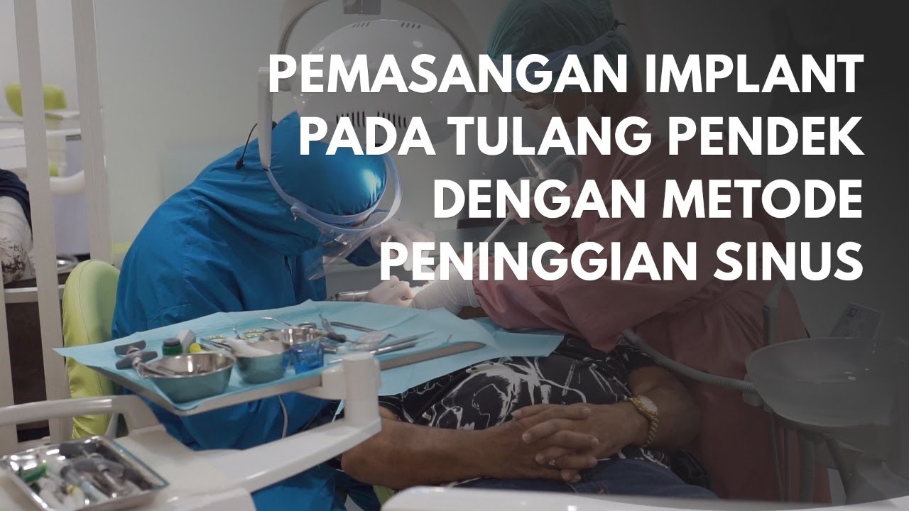 Pemasangan Implant Pada Tulang Pendek Dengan Metode Peninggian Sinus ...