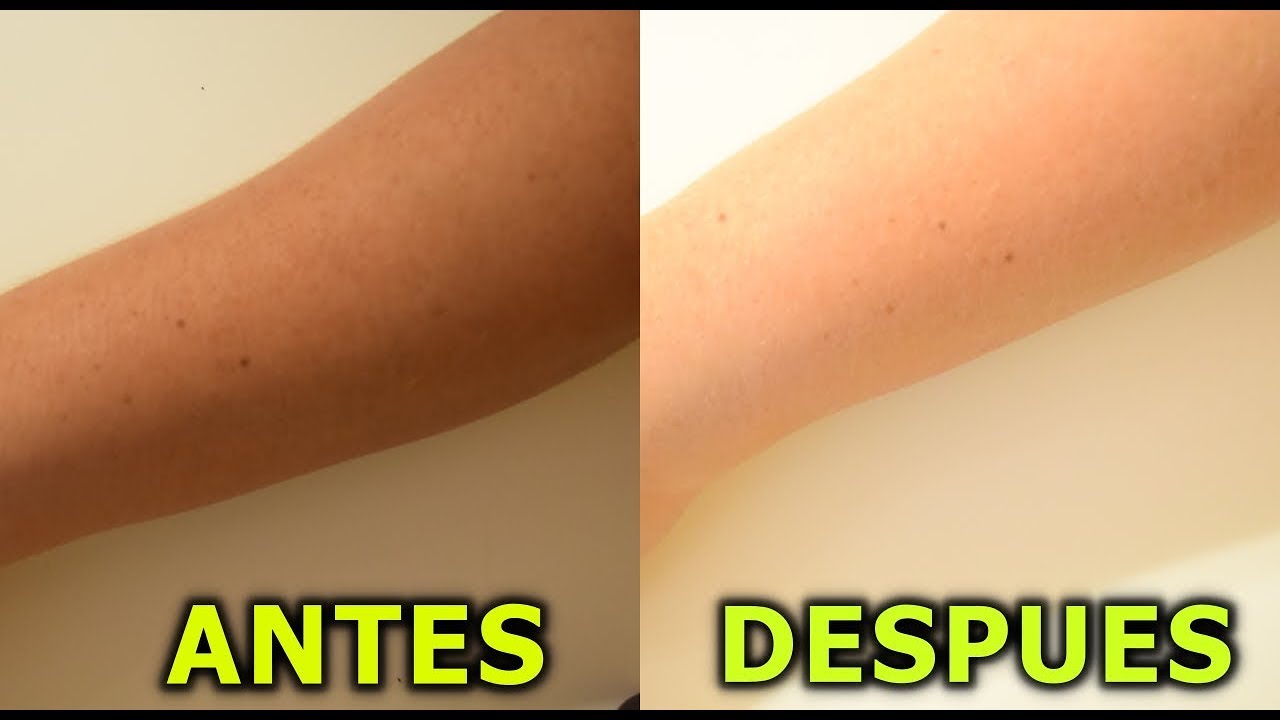 Como eliminar el bronceado y aclarar la piel rápidamente de forma ...
