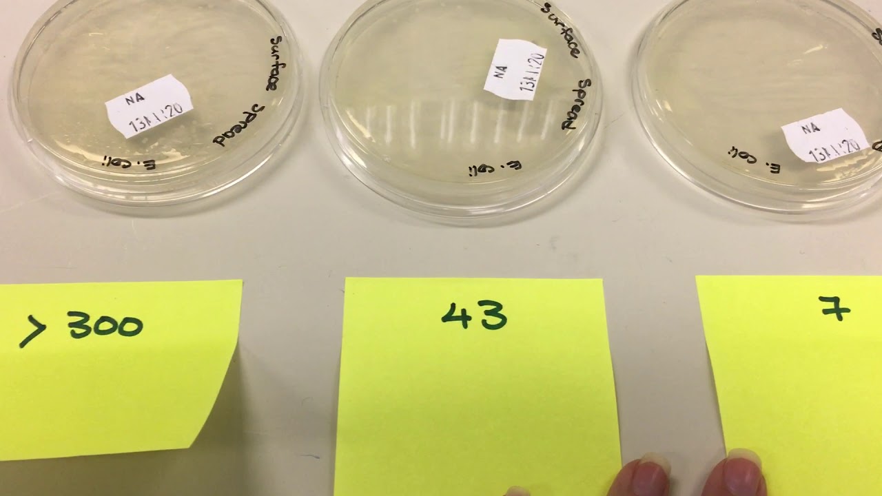Prac 3 The Microbial World Results Day 1 - YouTube