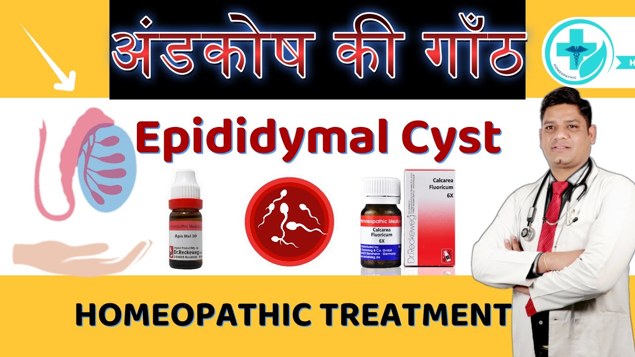 Epididymal Cyst Homeopathic Medicine Best Treatment For Epididymitis Epididymal Cyst Homeopathic Medicine Best Treatment For Epididymitis