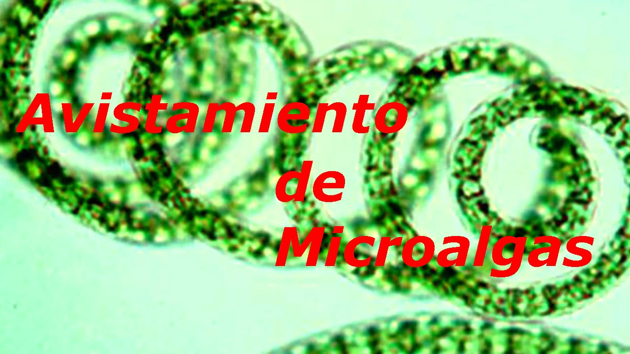 Avistamiento de microalgas y protozoos al microscopio (100x) - YouTube