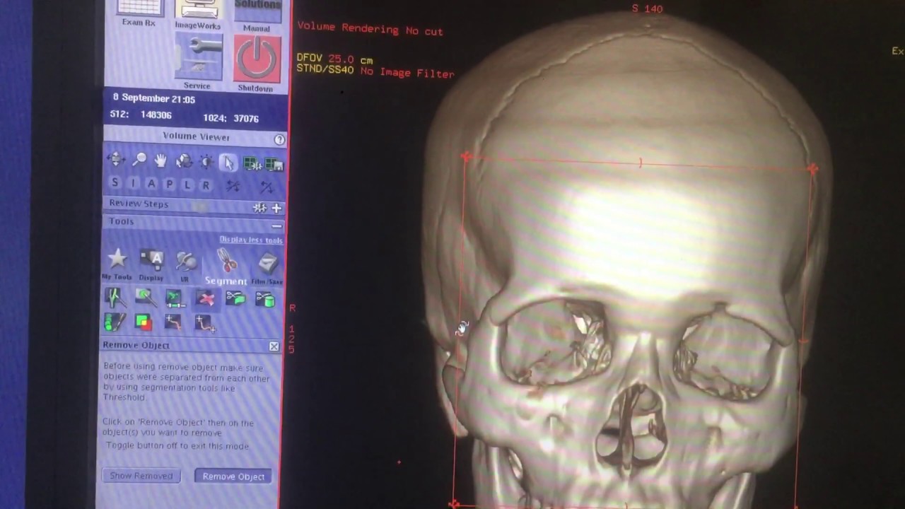 How to change to 3D view of Head scanners - YouTube