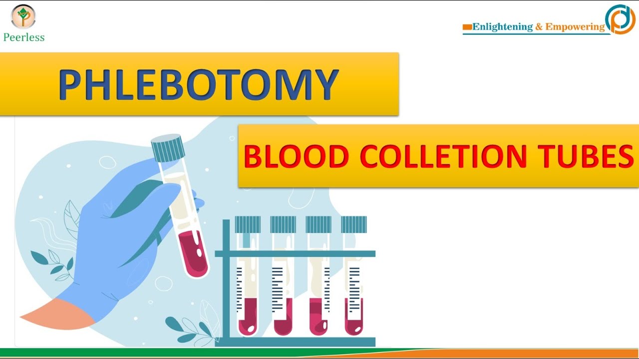 Blood Collection Tubes in Phlebotomy - Colour Coding of Blood ...