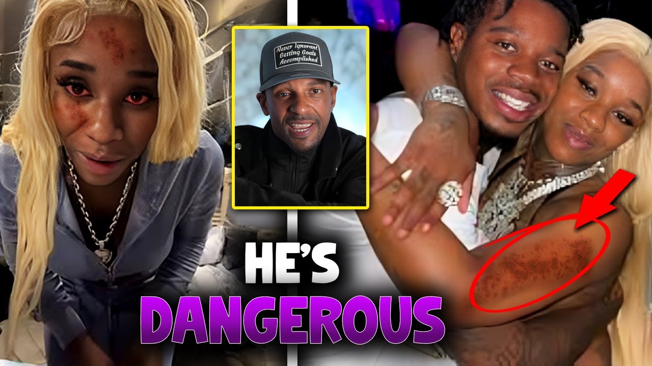 Sexyy Red GOT an Infection From GucciThirdLeg? Charleston White Was ...