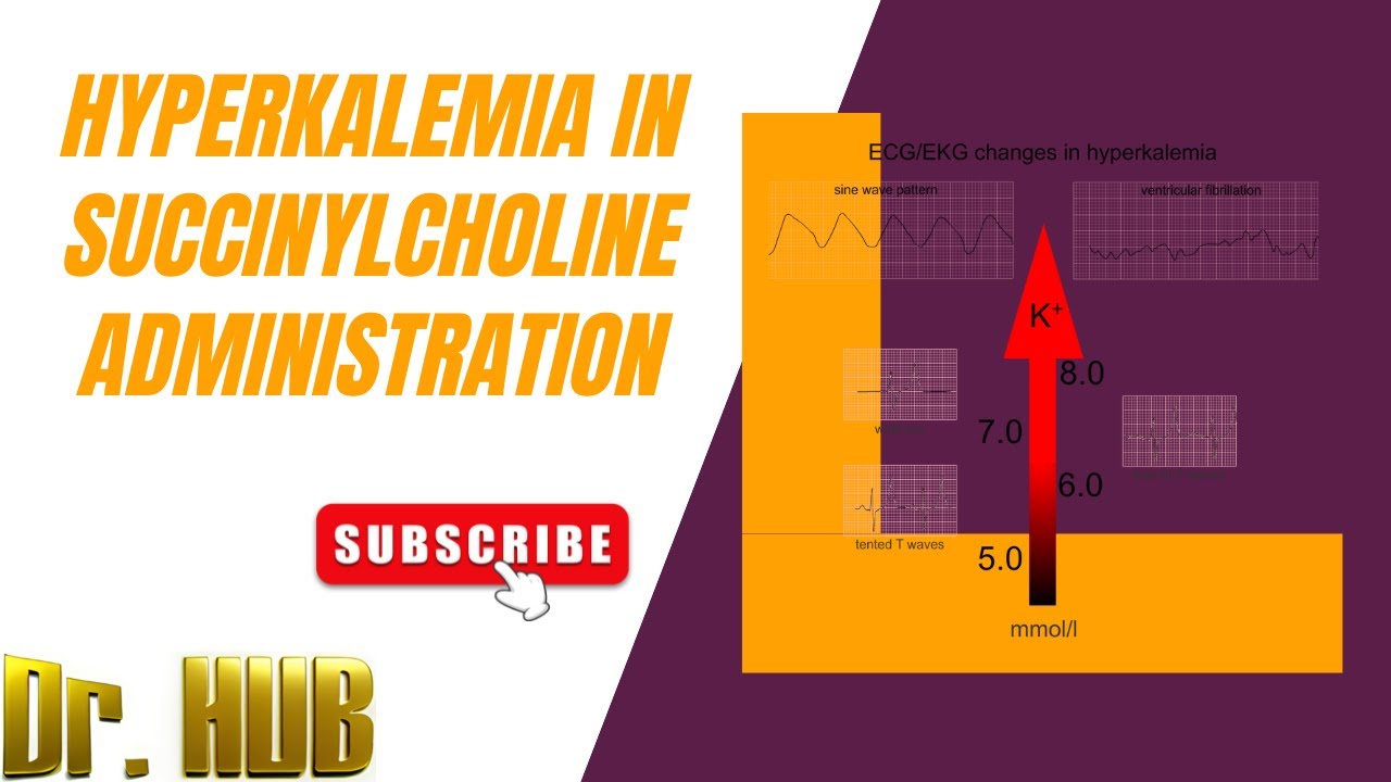 Hyperkalemia in succinylcholine administration - YouTube