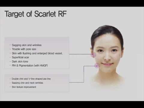 Beauty Equipment Introducing Scarlet Fractional RF (Microneedle) - YouTube
