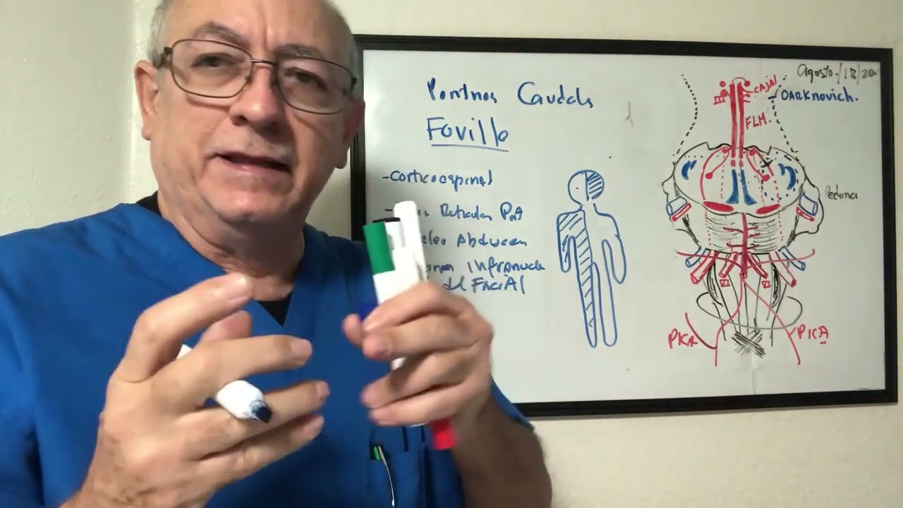 Foville' Syndrome paso a paso Pontino caudal - YouTube