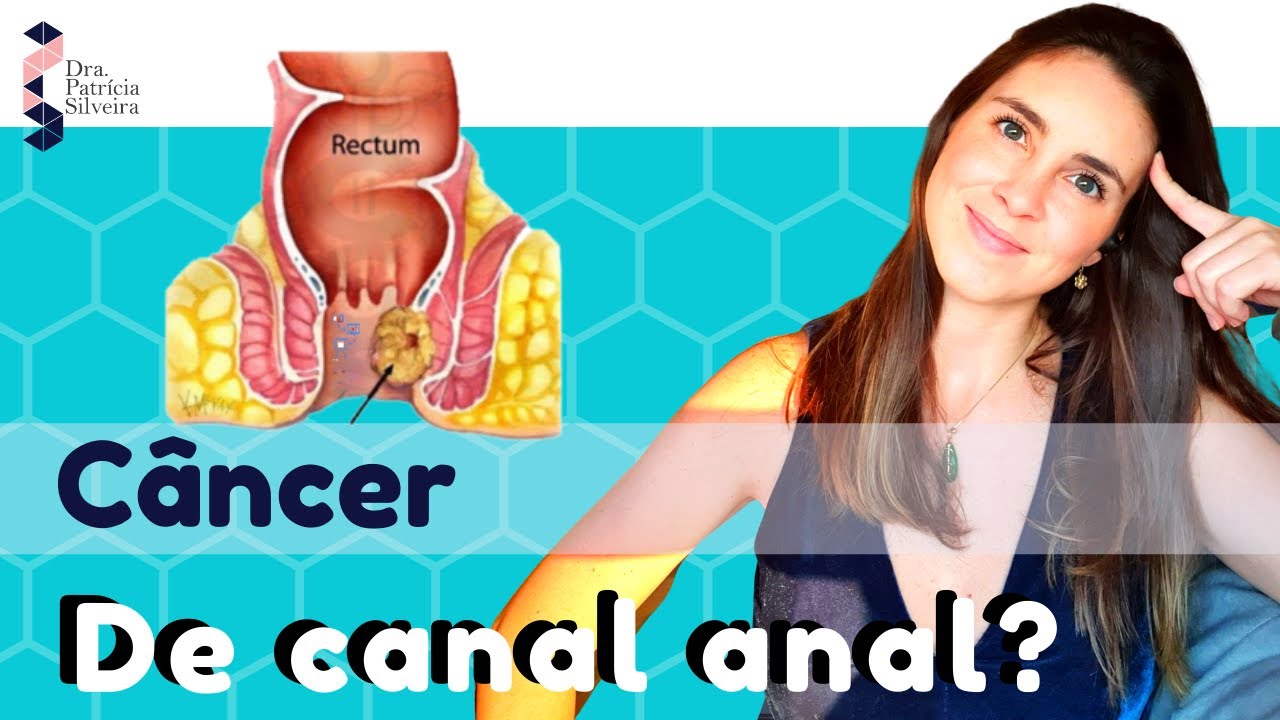 CÂNCER DE ÂNUS - É DIFERENTE DE CÂNCER DE INTESTINO? - YouTube