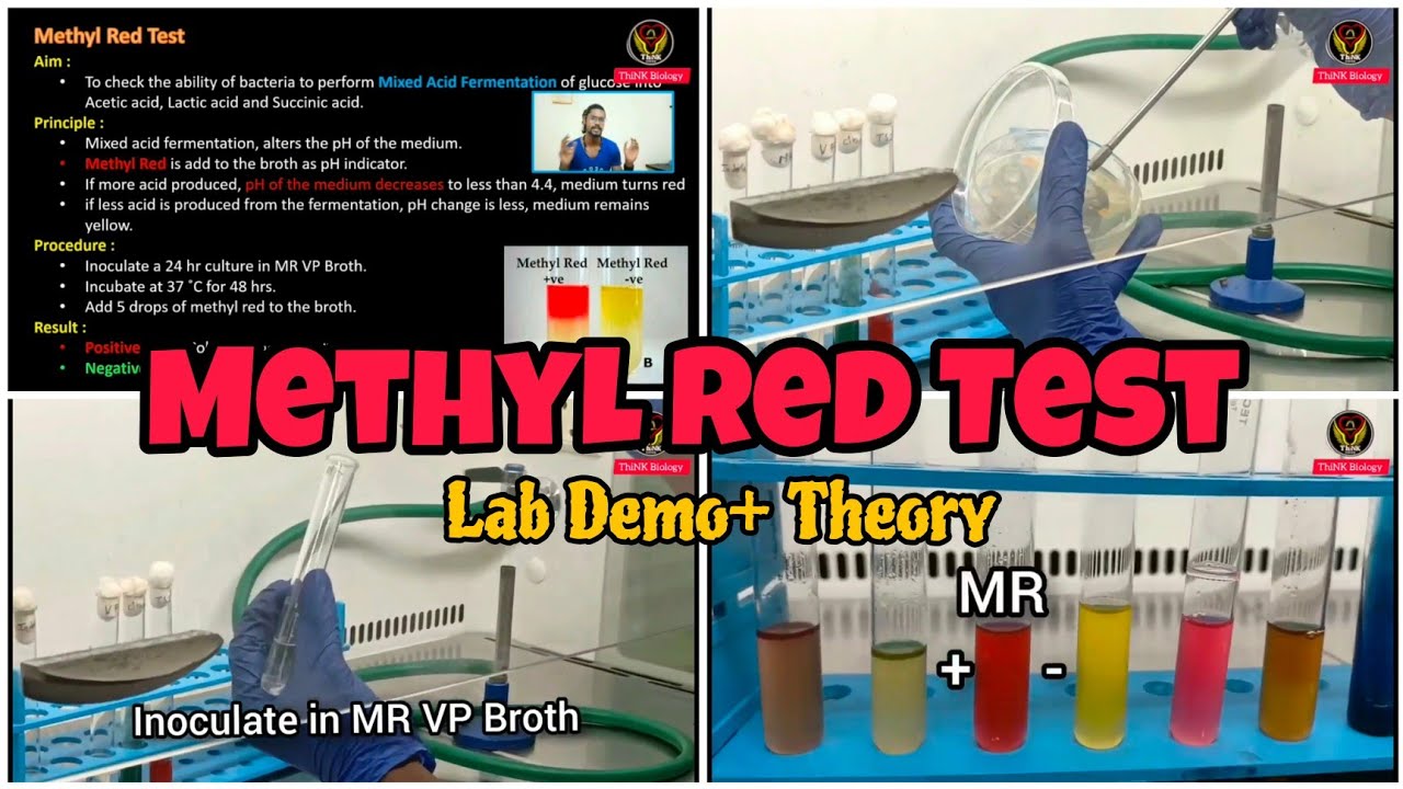 Methyl Red Test | Tamil | Lab Demo | Biochemical | ThiNK Biology - YouTube
