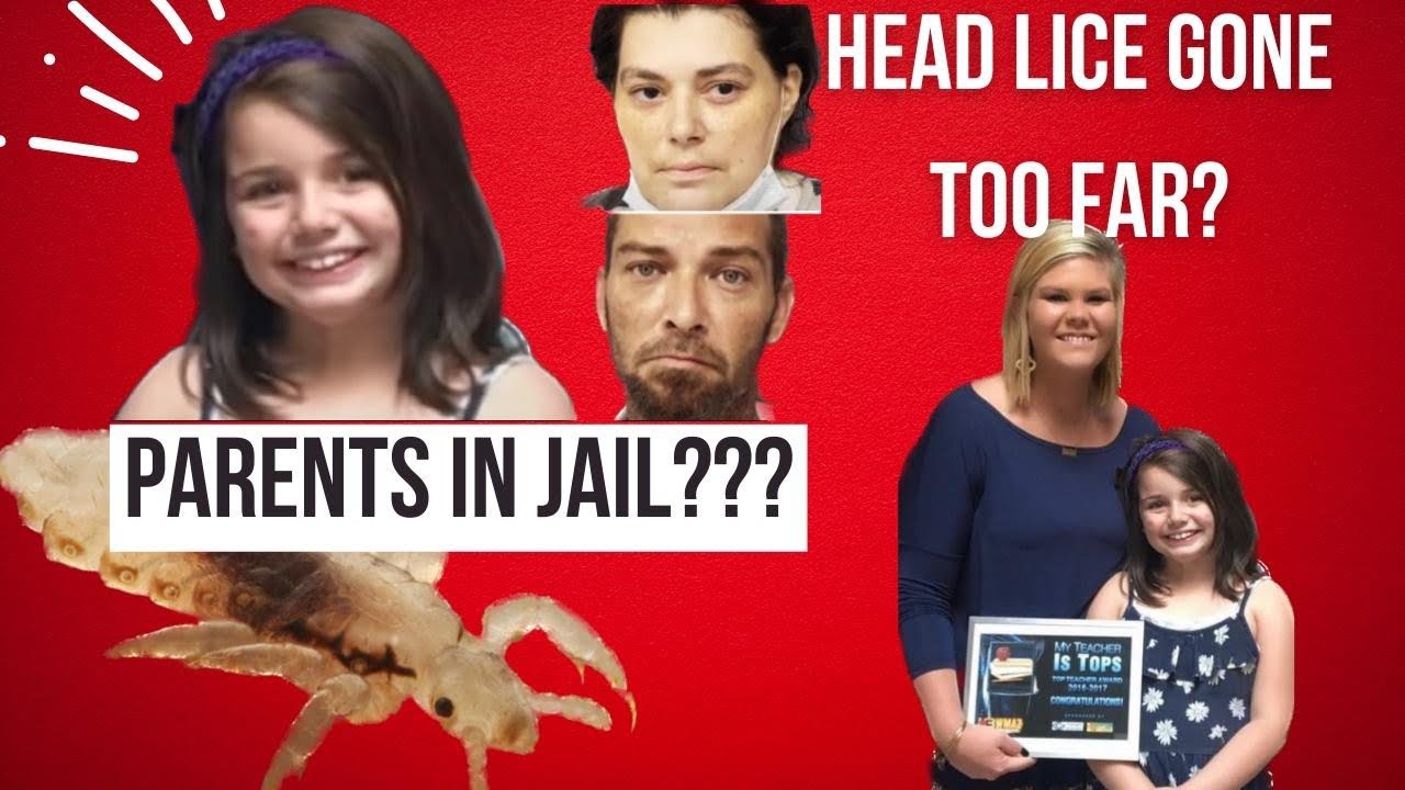 World's Worst Lice Case Does The Unthinkable!!! - YouTube