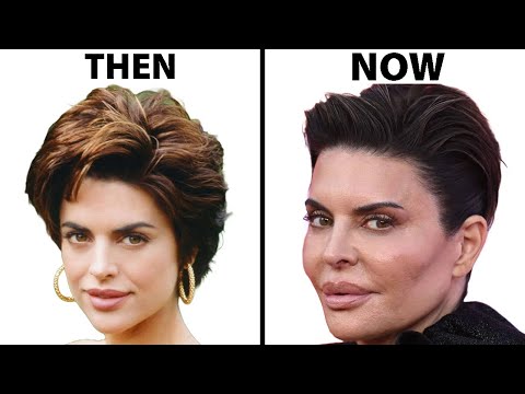Lisa Rinna's NEW FACE | Plastic Surgery Analysis