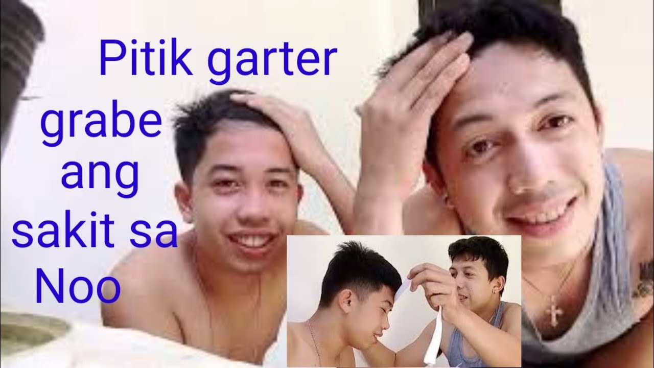 Pitik garter sa Noo grabe ang sakit sa Noo #Brosbro TV - YouTube