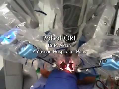 Chirurgie Robot DA VINCI orl /Surgery DA VINCI Robot ENT - YouTube
