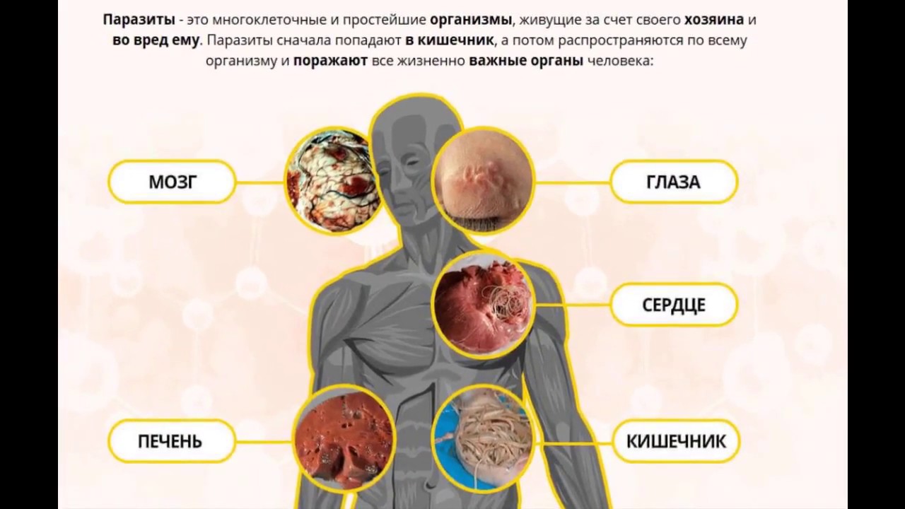 Come eliminare i parassiti intestinali - YouTube