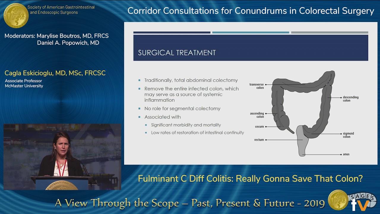 Fulminant C Diff Colitis Really Gonna Save That Colon YouTube Fulminant C Diff Colitis Really Gonna Save That Colon YouTube