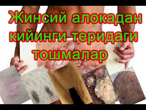 Тасодифий жинсий алокадан кийинги теридаги тошмалар
