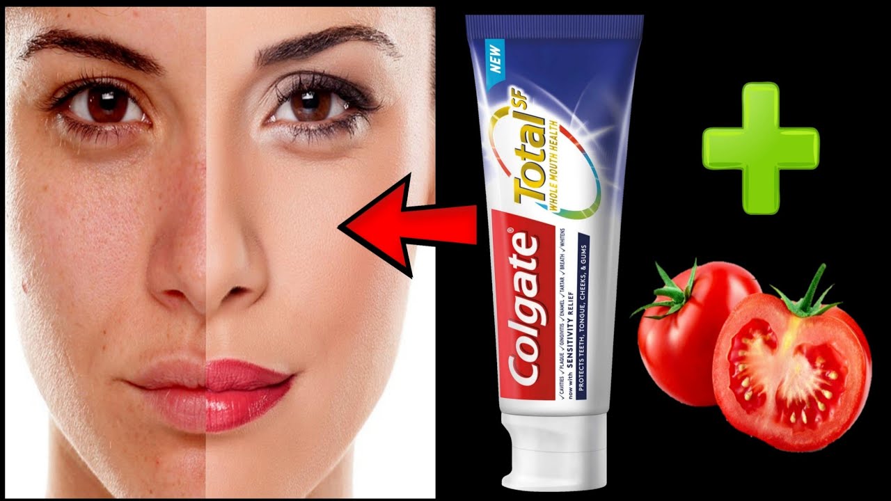 Skin whitening Treatment from Colgate Toothpaste and Tomato ...