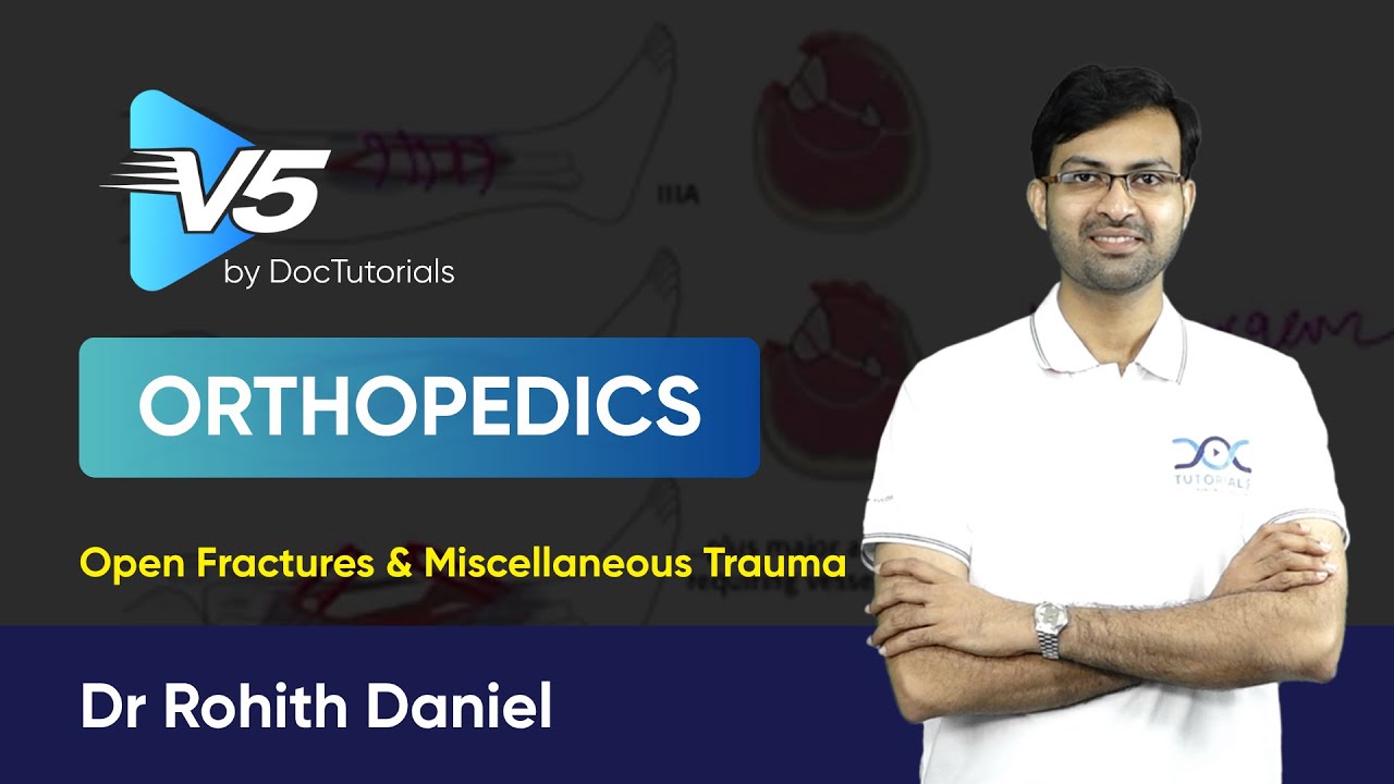 Orthopedics – Open Fractures | Sample Video by DocTutorials V5 - Dr ...