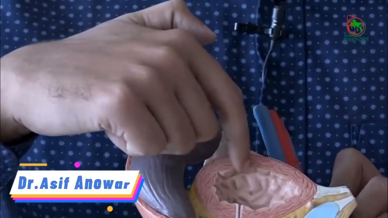 পুরষদের প্রসাবে জ্বালাপোরা কেনো হয় এবং হলে কি করা উচিৎ! Dr.Asif Anowar - YouTube