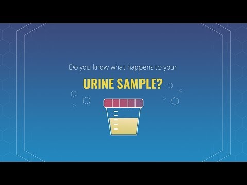 How Can You Tell If A Urine Sample Is Contaminated