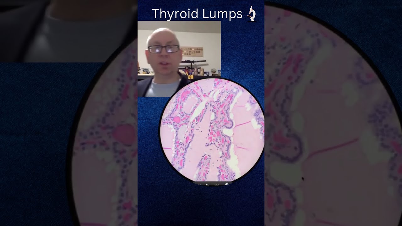 Thyroid pathology lecture – Trailer – Oral Pathology 360