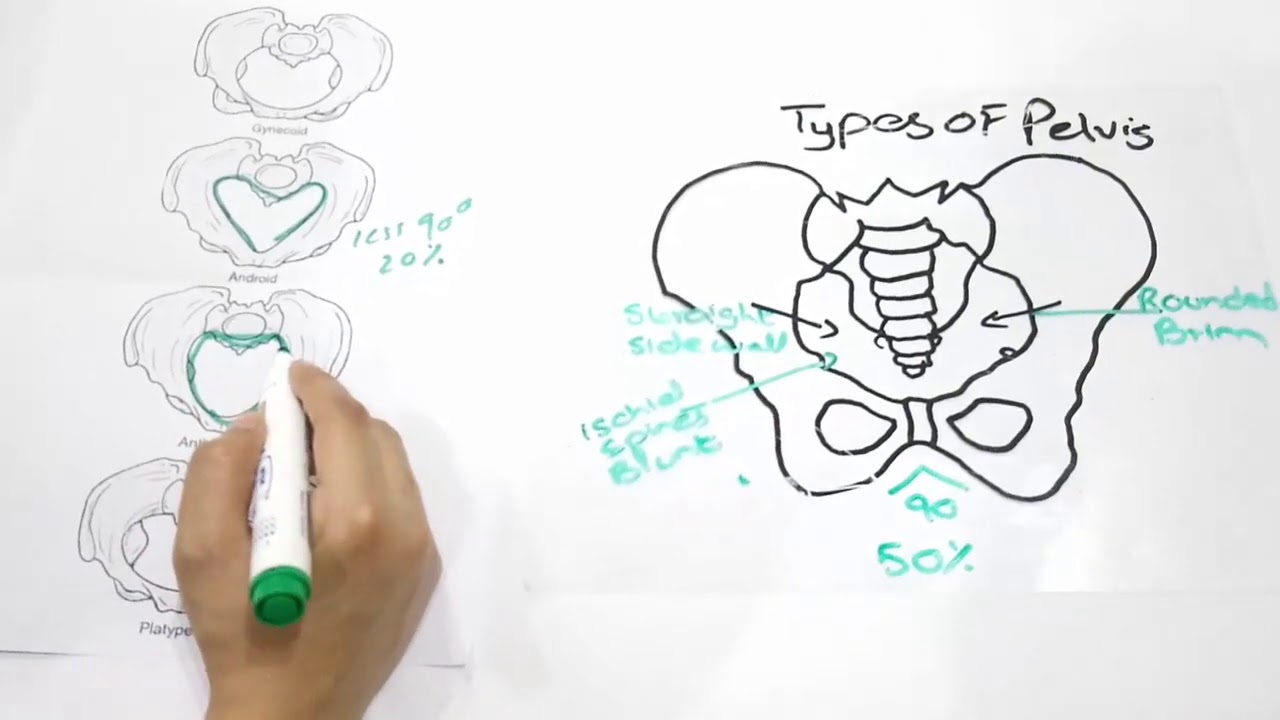 Types of Pelvis - YouTube