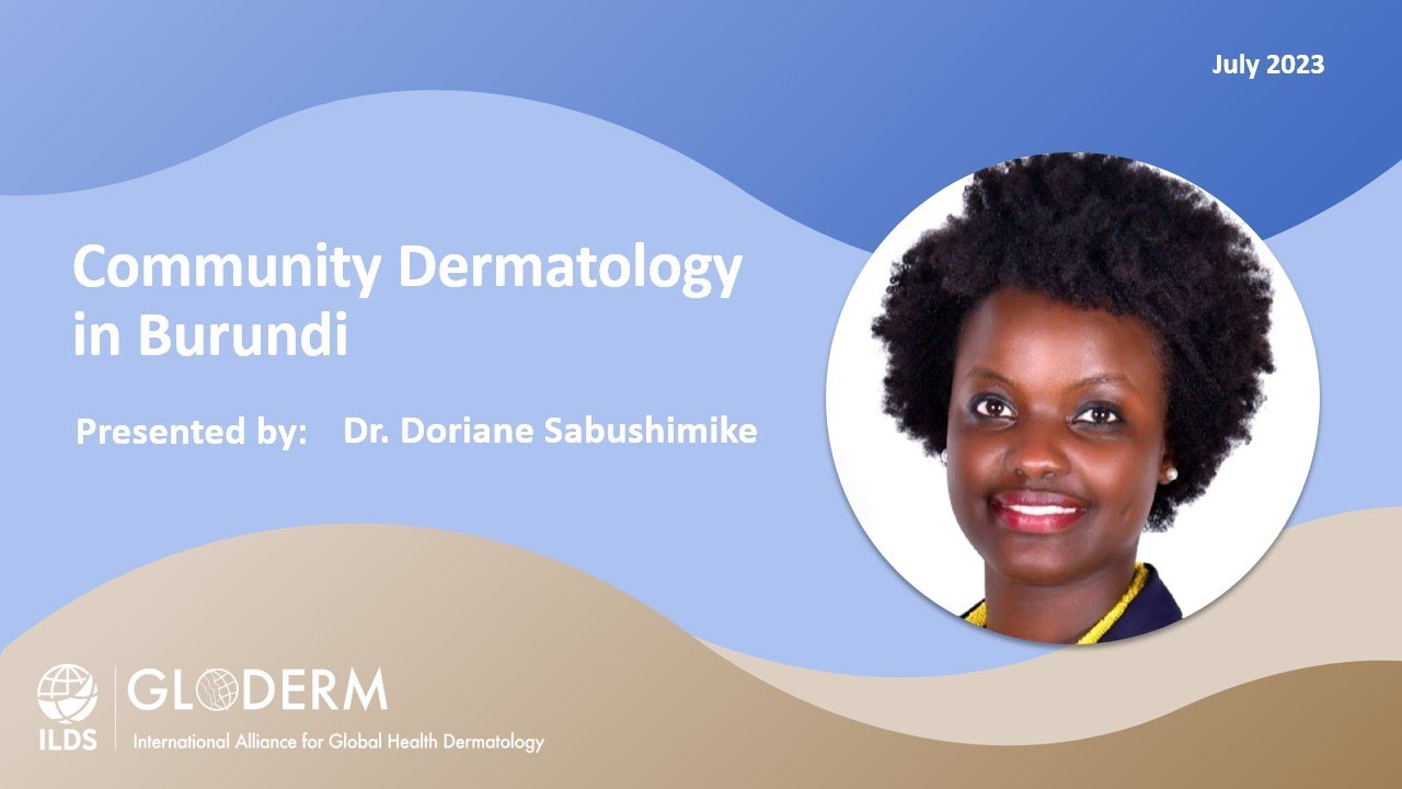 GLODERM Mentee Presentation | Doriane Sabushimike - YouTube