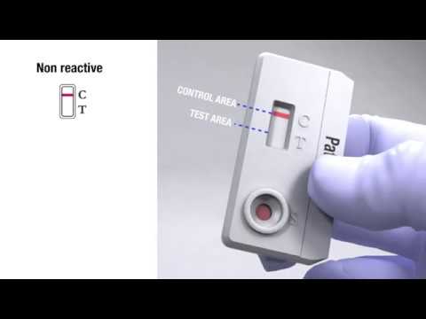 How to Use Chembio's STAT-PAK HIV Test - YouTube