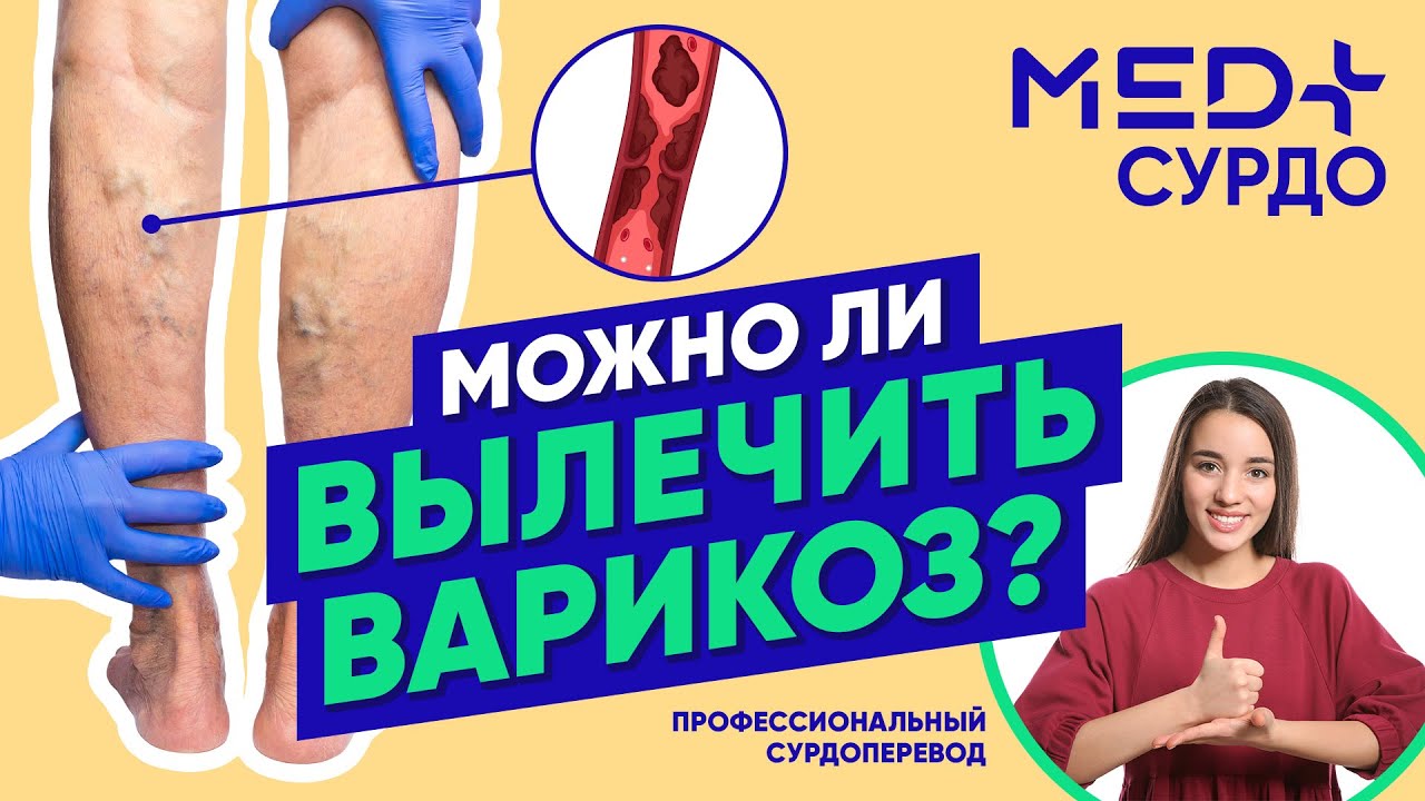 Лечение варикоза на ногах. Сосудистая сетка, тяжесть в ногах: ваши вены ...