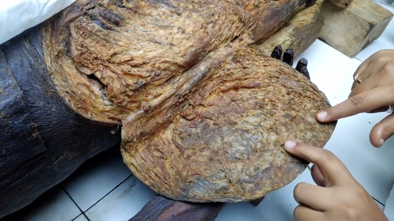 Dissection, mussels, Anatomy, 1st prof viva. - YouTube