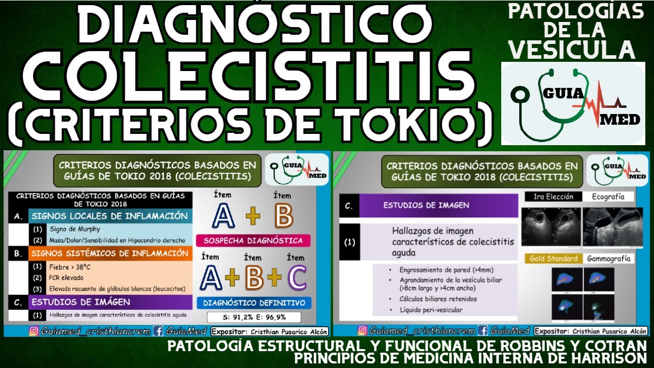 Classificação De Tokyo Colecistite - RETOEDU