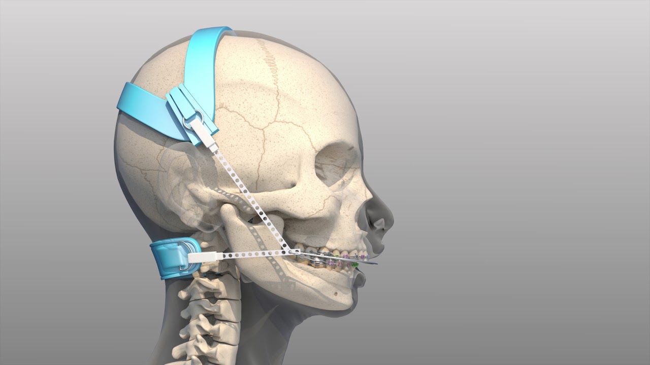 Traditional Headgear - YouTube