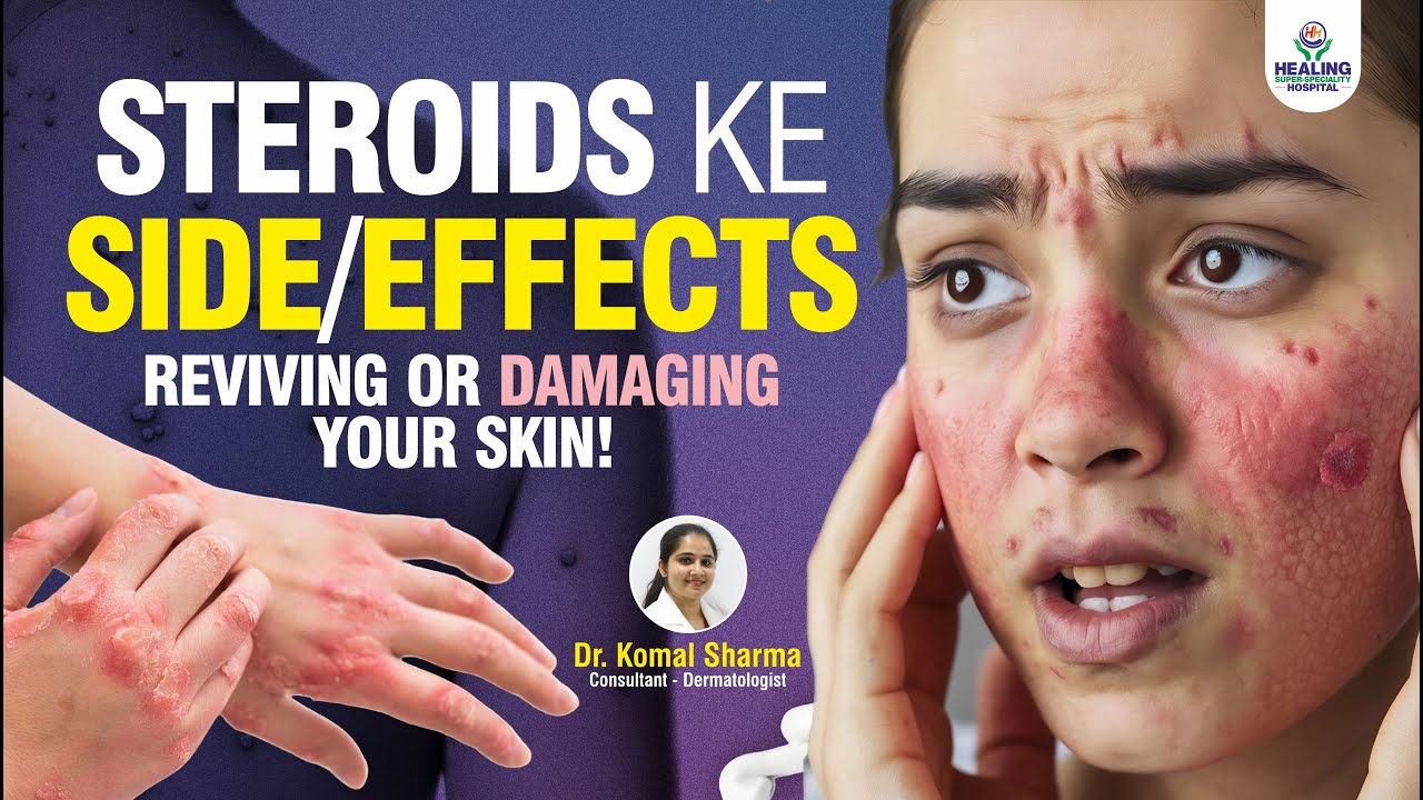 Steroids: Benefits, Risks, and Proper Usage in Dermatology | Healing ...