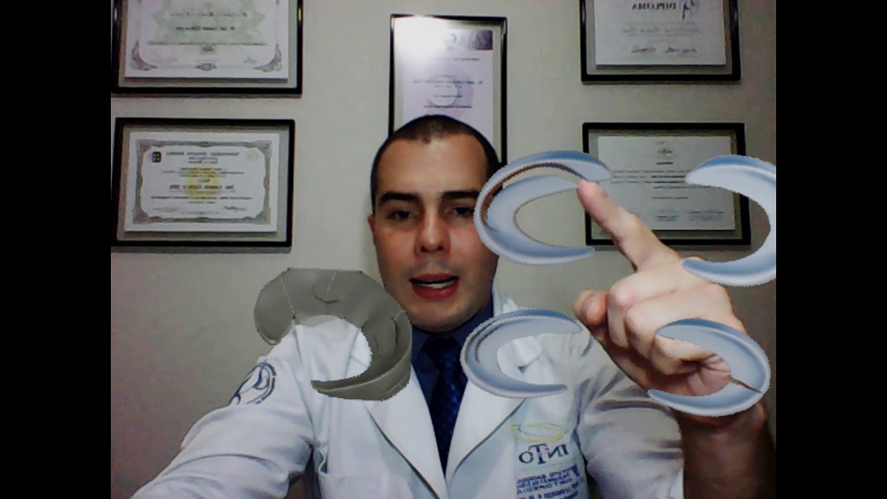 Menisco rompido, rompi o menisco, tenho que operar ?? Cirurgia de ...