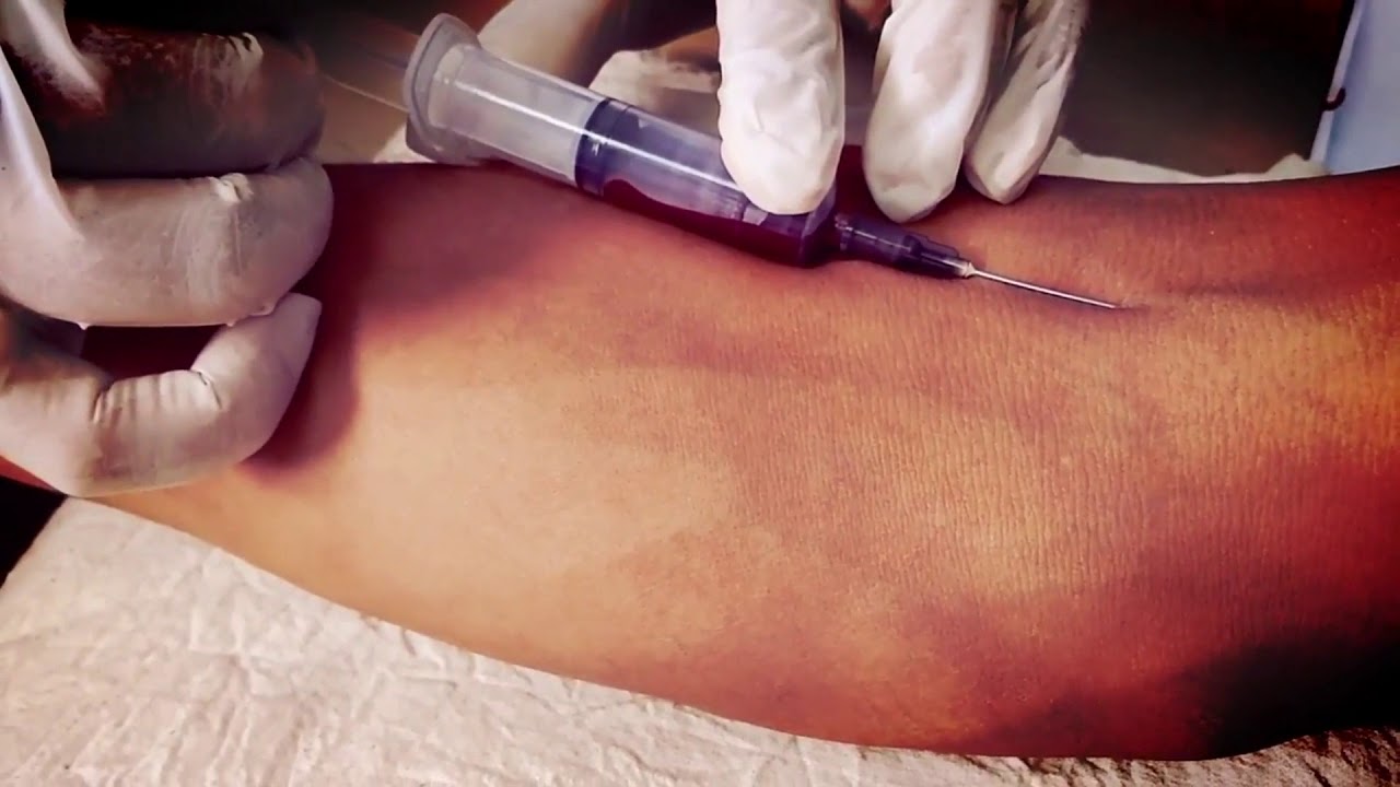 General Health Check Up And List Of Lab Tests YouTube general-health-check-up-and-list-of-lab-tests-youtube