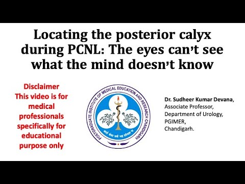 Finding posterior calyx during PCNL: Educative video - YouTube